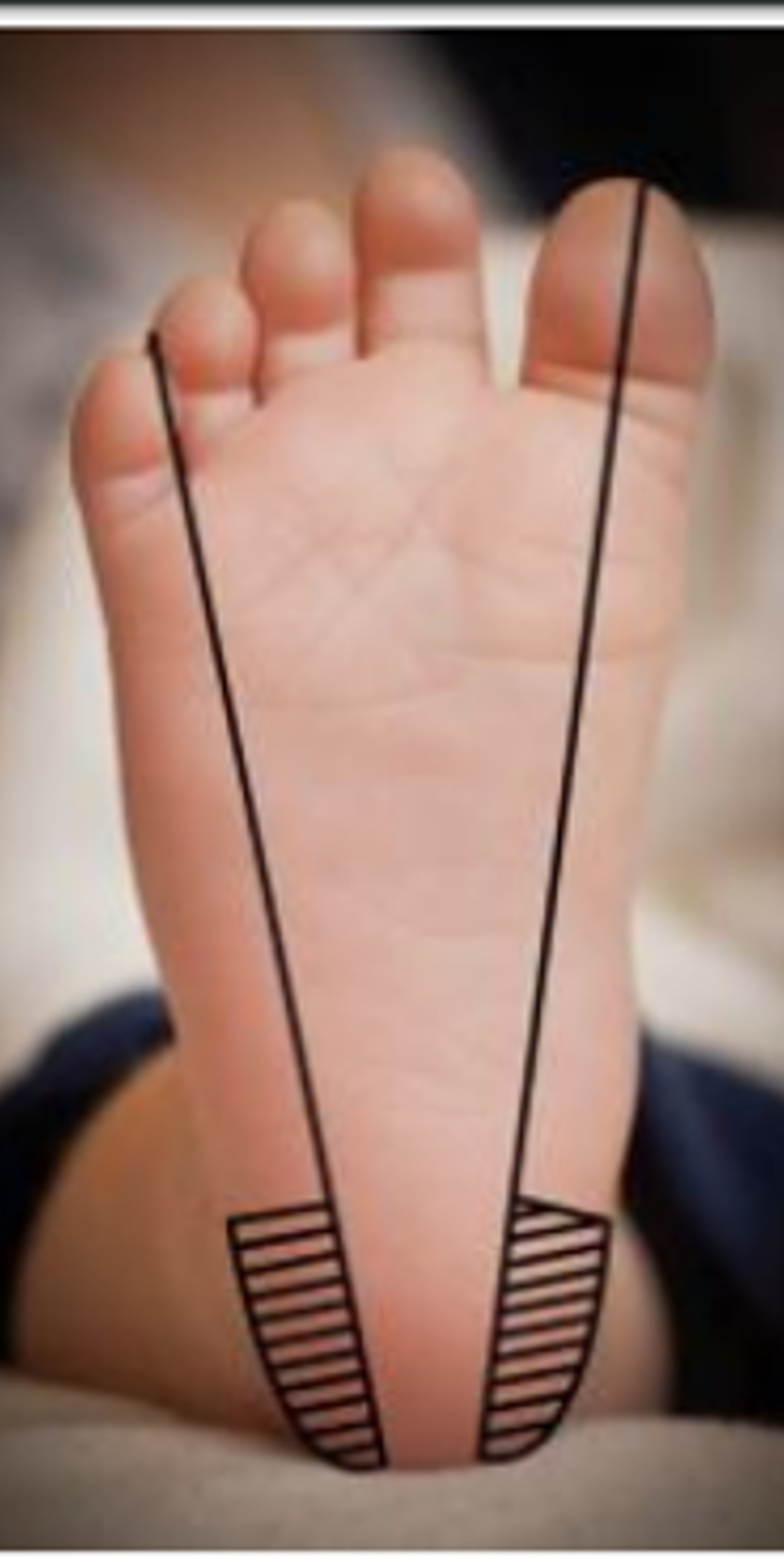 Collection Procedure | Submitter Hub